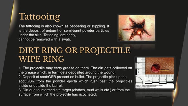 Forensic BALLISTICS # Identification of range of fire through wound ...