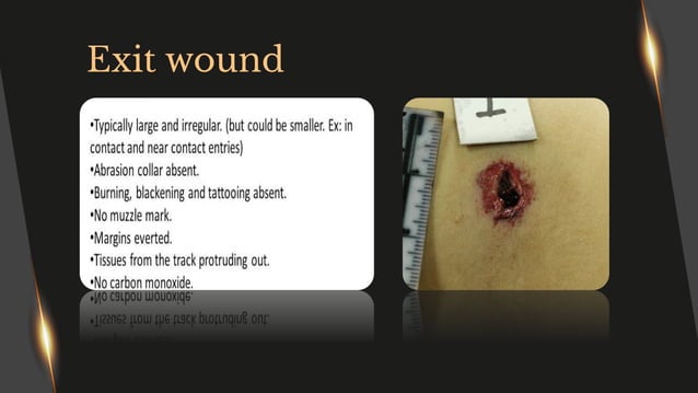 Forensic BALLISTICS # Identification of range of fire through wound ...