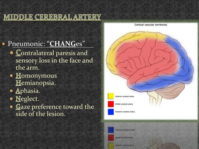 stroke ( ischemic stroke ) | PPTX