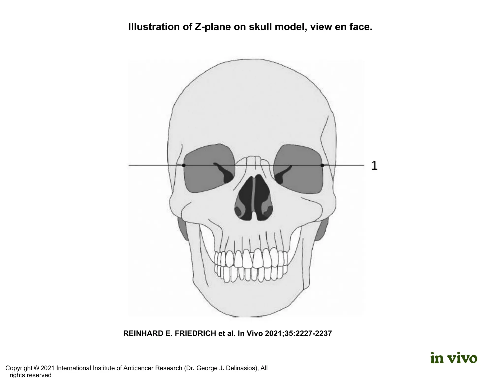 Skull symmetry. Plans. .ppt