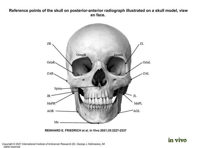 Skull symmetry. Plans. .ppt