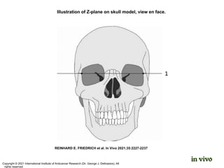 Skull symmetry. Plans. .ppt