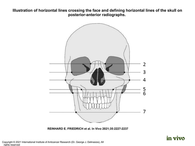 Skull symmetry. Plans. .ppt