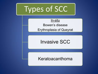 222821042 squamous-cell-carcinoma | PPTX