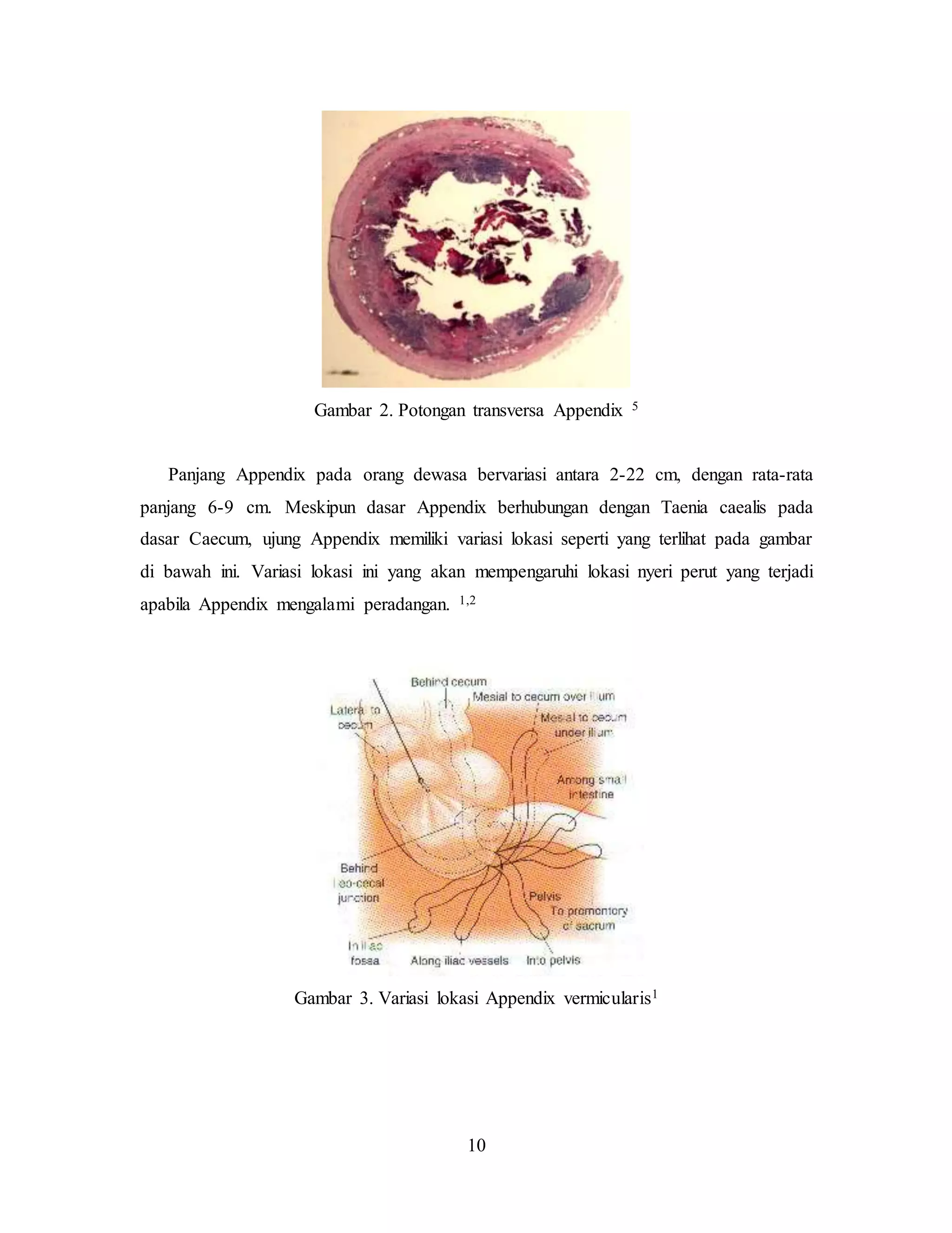 225881539 appendisitis-akut-laporan-kasus | DOC