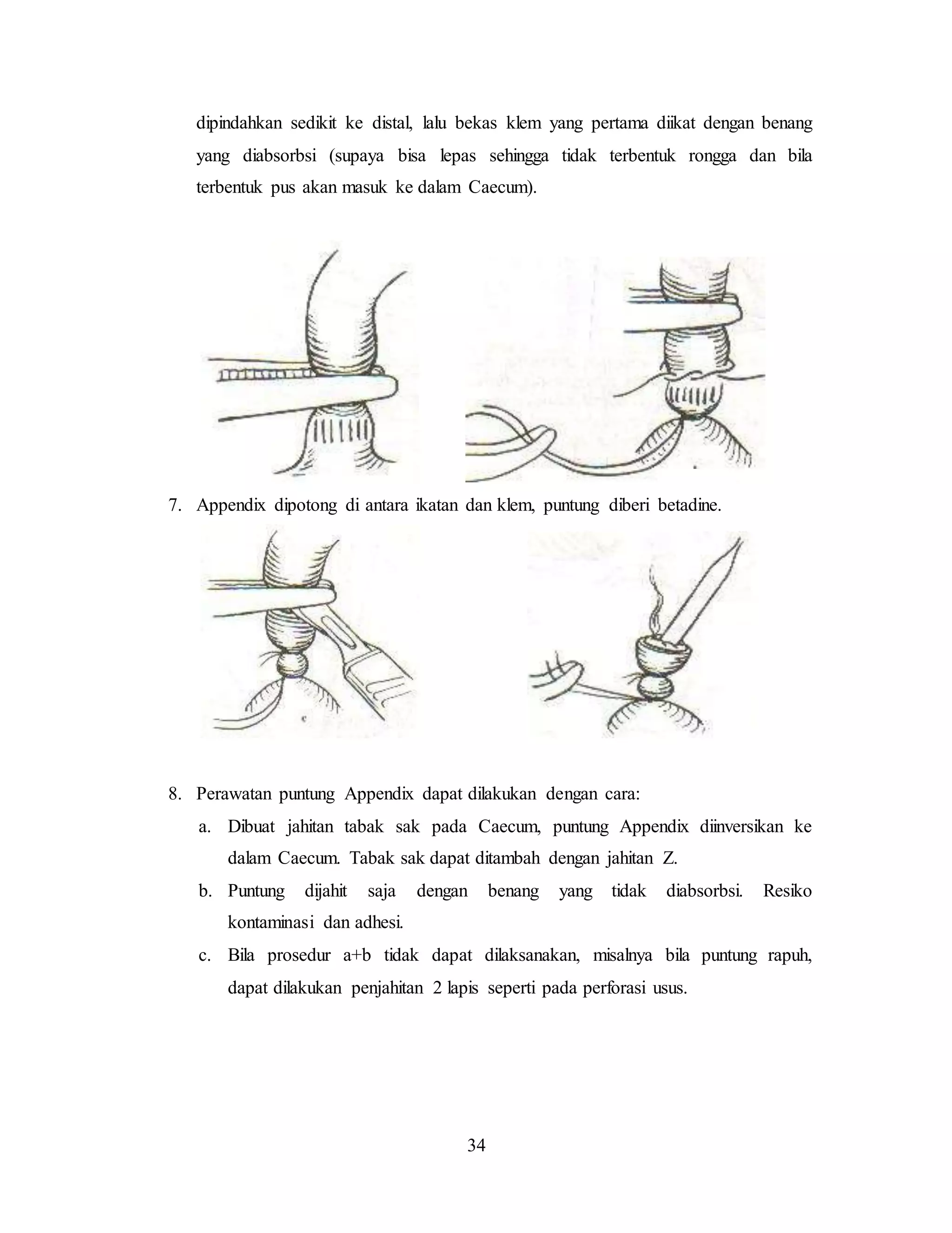 225881539 appendisitis-akut-laporan-kasus | DOC