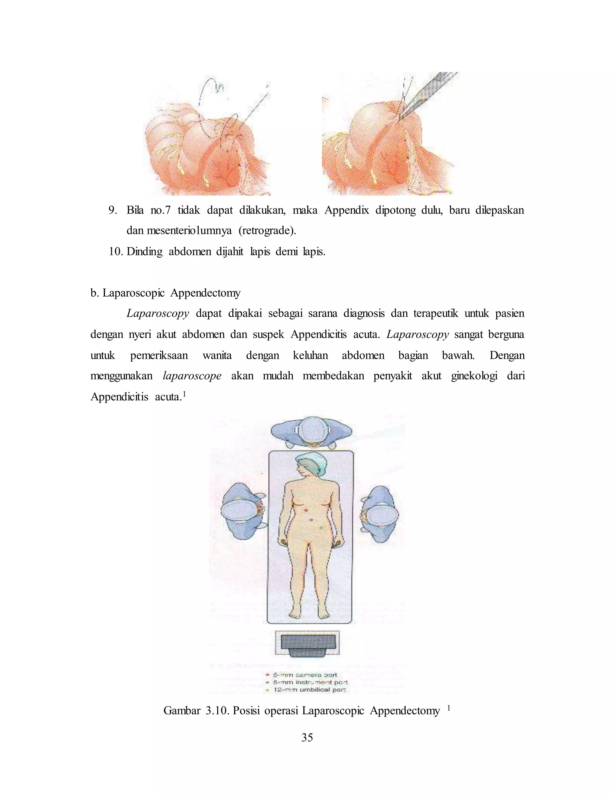225881539 appendisitis-akut-laporan-kasus | DOC