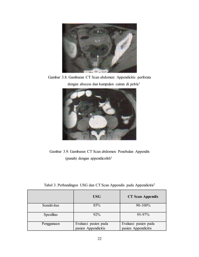 225881539 appendisitis-akut-laporan-kasus | DOC
