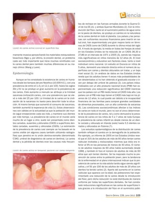 Definiendo caries dental | PDF
