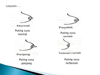 227154690-PPT-Anatomi-Dan-Fisiologi-Payudara.pptx