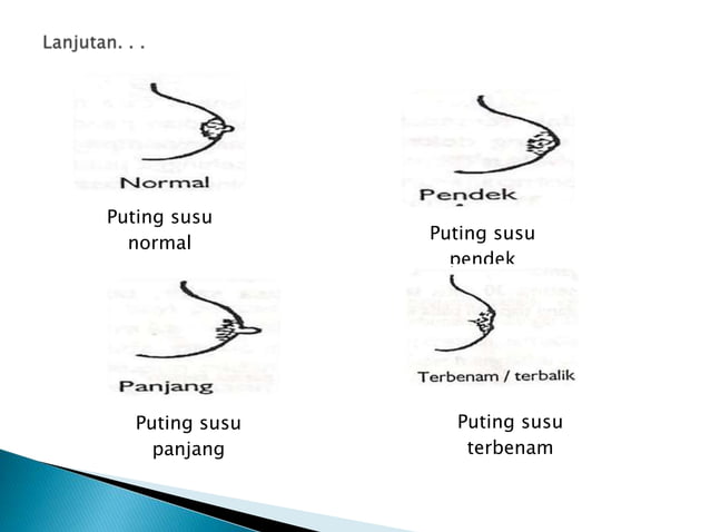 227154690-PPT-Anatomi-Dan-Fisiologi-Payudara.pptx