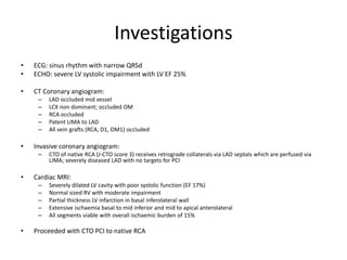 CTO PCI using LIMA as Retrograde Conduit - Saqib Ghani | PPTX