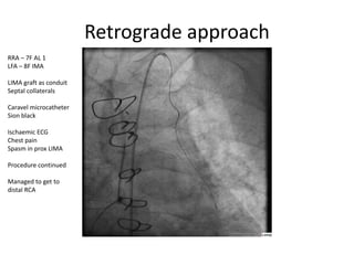 CTO PCI using LIMA as Retrograde Conduit - Saqib Ghani | PPTX
