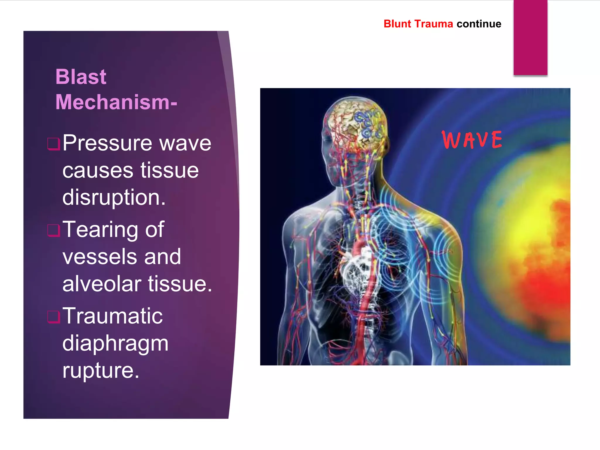 Mechanism of torso trauma - surgery | PPTX