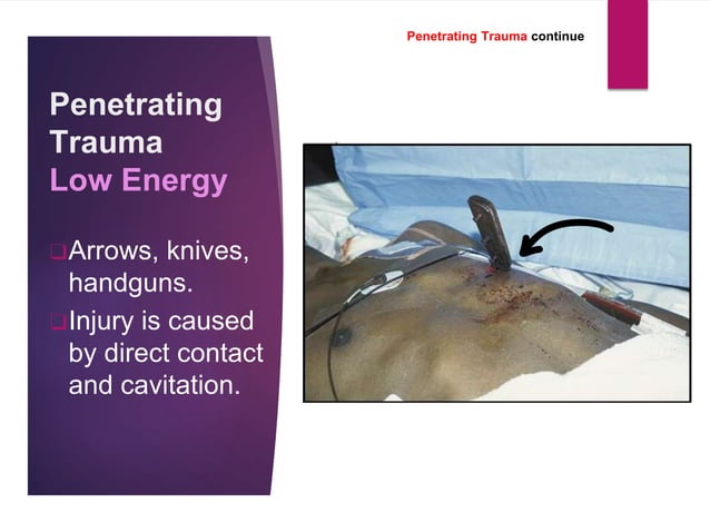 Mechanism of torso trauma - surgery | PPTX | Death, Injury, or Military ...