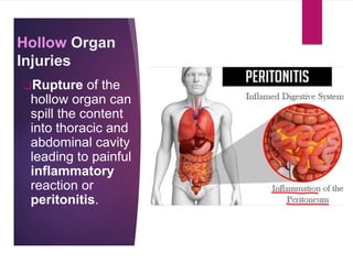 Mechanism of torso trauma - surgery | PPTX
