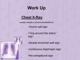 Pneumomediastinum | PPSX