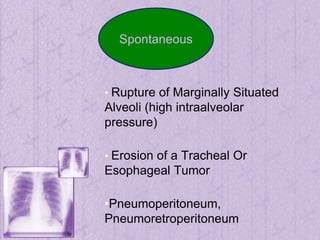 Pneumomediastinum | PPSX