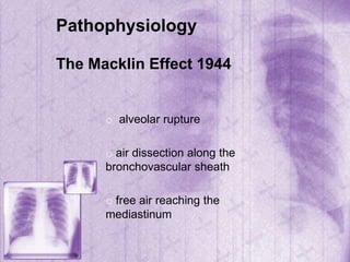 Pneumomediastinum | PPSX