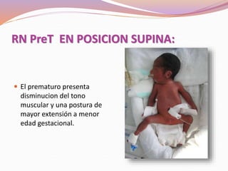 22 EXAMEN FISICO DEL RN.ppt diapositivas | PPT