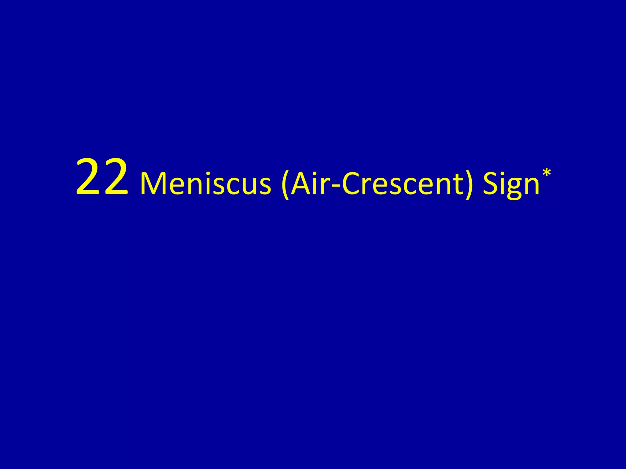 22 meniscus (air crescent) sign | PPT