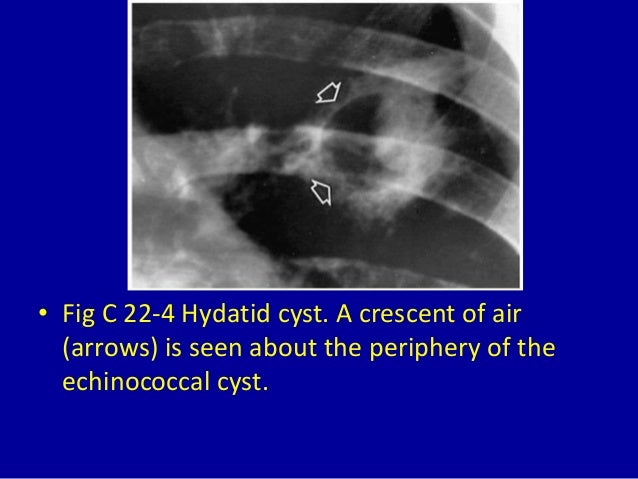 Air Crescent Sign