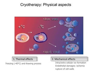 ECCLU 2011 - F.J. Murat - Prostate cancer: All the truth about local ...