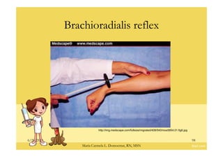 Brachioradialis Reflex