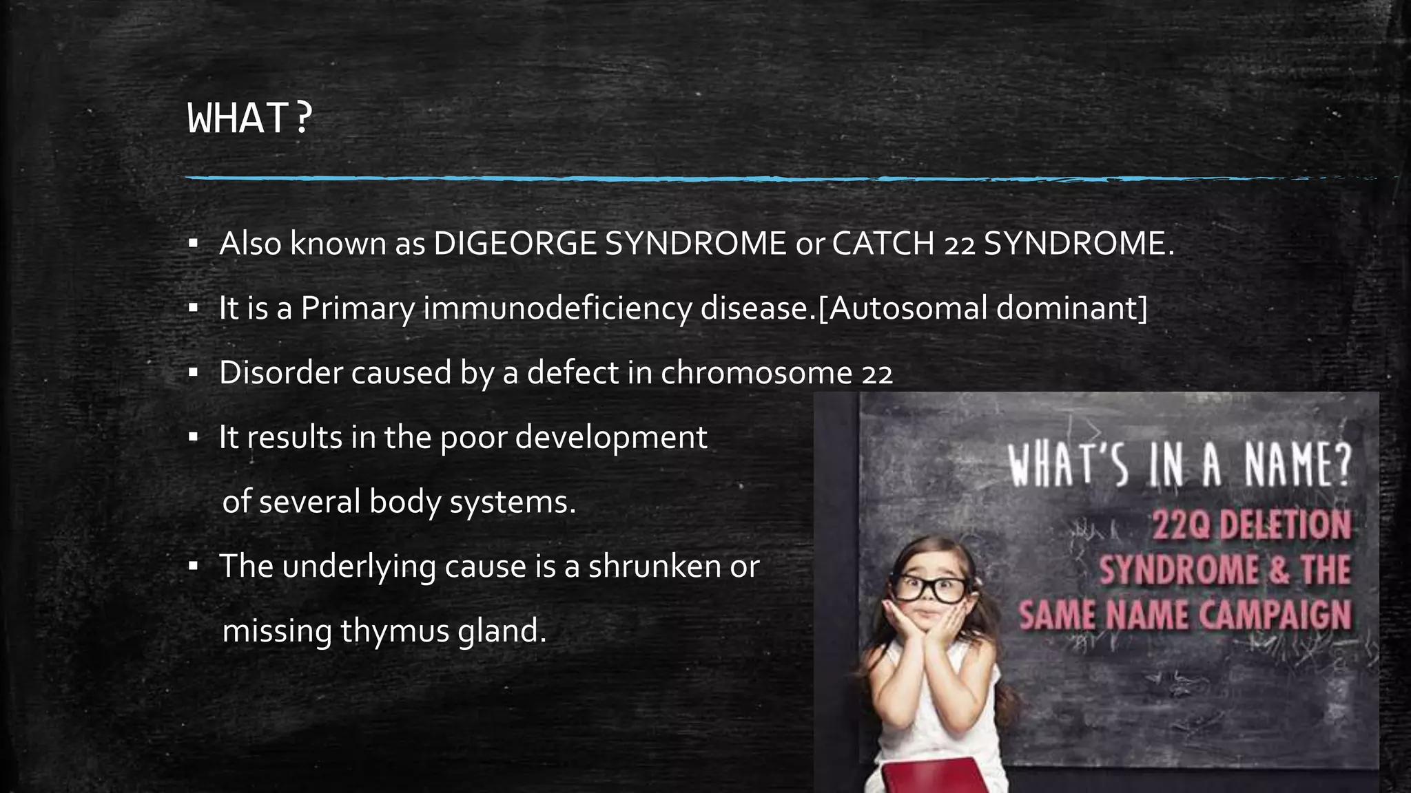 Digeorge syndrome | PPTX