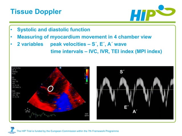 Functional Echocardiography. Targeted neonatal echocardiography (TNE). Point of care ...