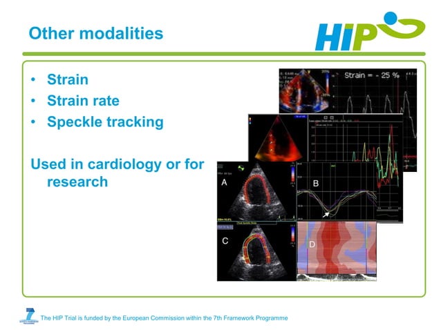 Functional Echocardiography. Targeted neonatal echocardiography (TNE). Point of care ...