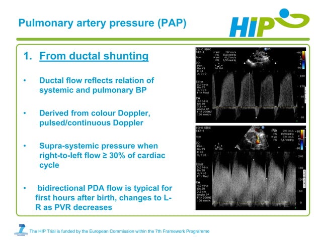 Functional Echocardiography. Targeted neonatal echocardiography (TNE). Point of care ...