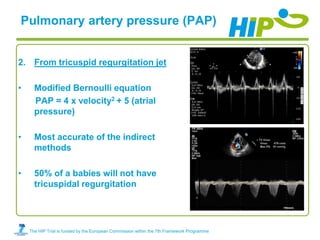Functional Echocardiography. Targeted neonatal echocardiography (TNE). Point of care ...