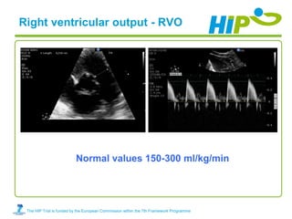 Functional Echocardiography. Targeted neonatal echocardiography (TNE ...