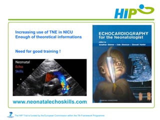 Functional Echocardiography. Targeted neonatal echocardiography (TNE). Point of care ...