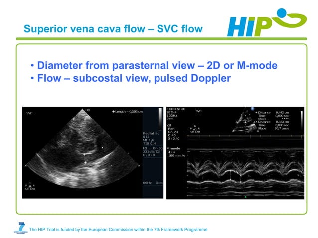 Functional Echocardiography. Targeted neonatal echocardiography (TNE). Point of care ...