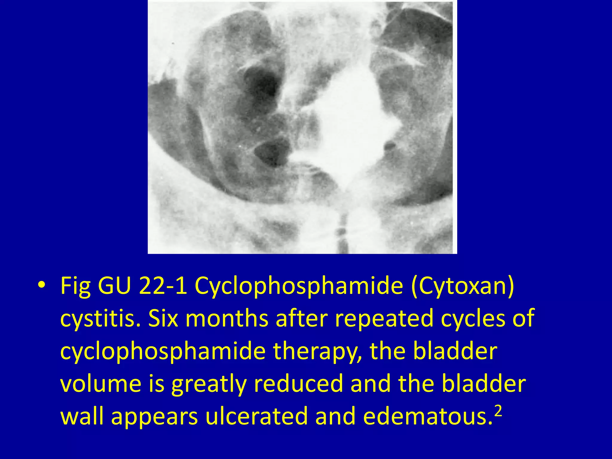 22 small urinary bladder | PPTX