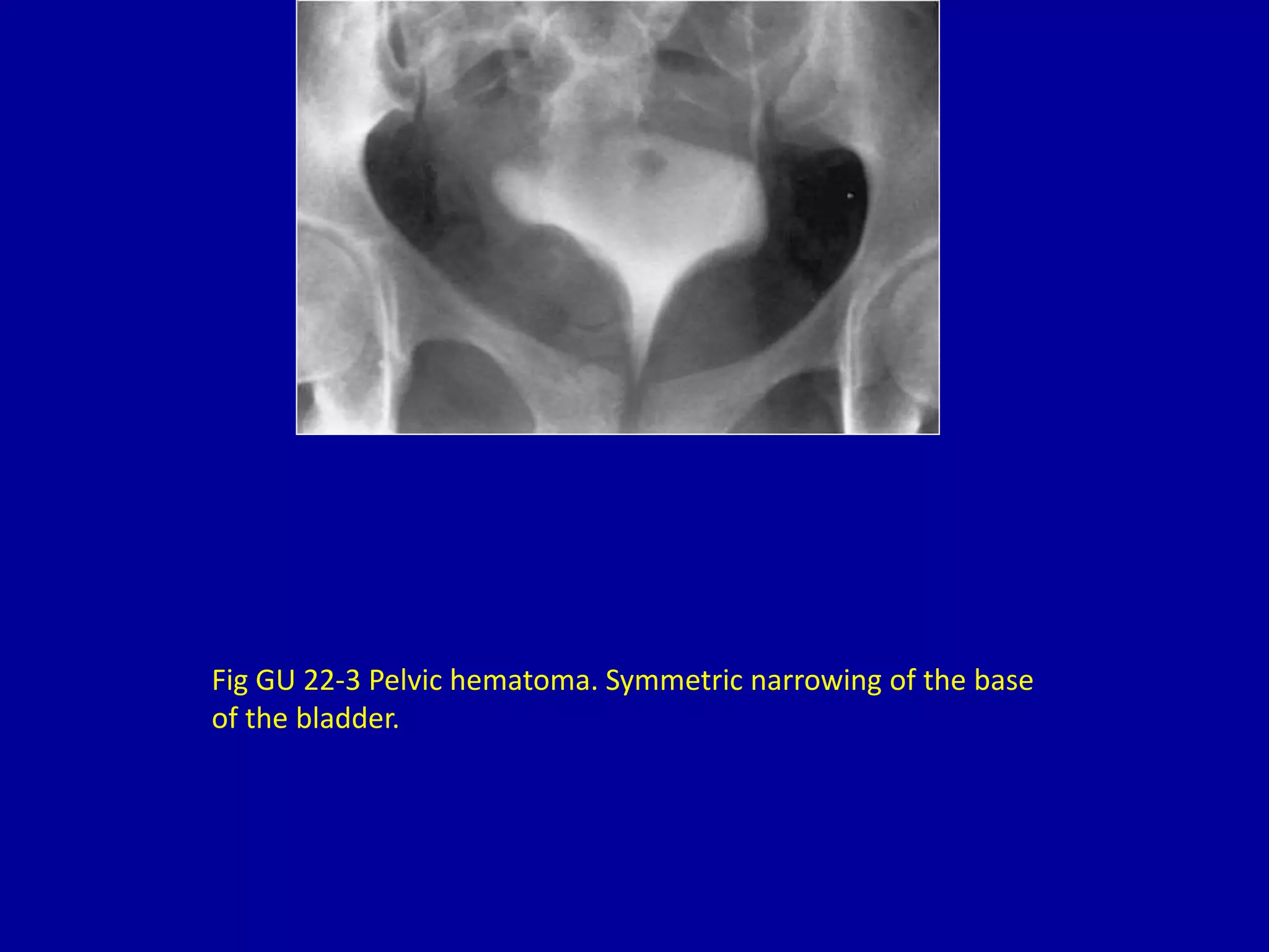 22 small urinary bladder | PPTX