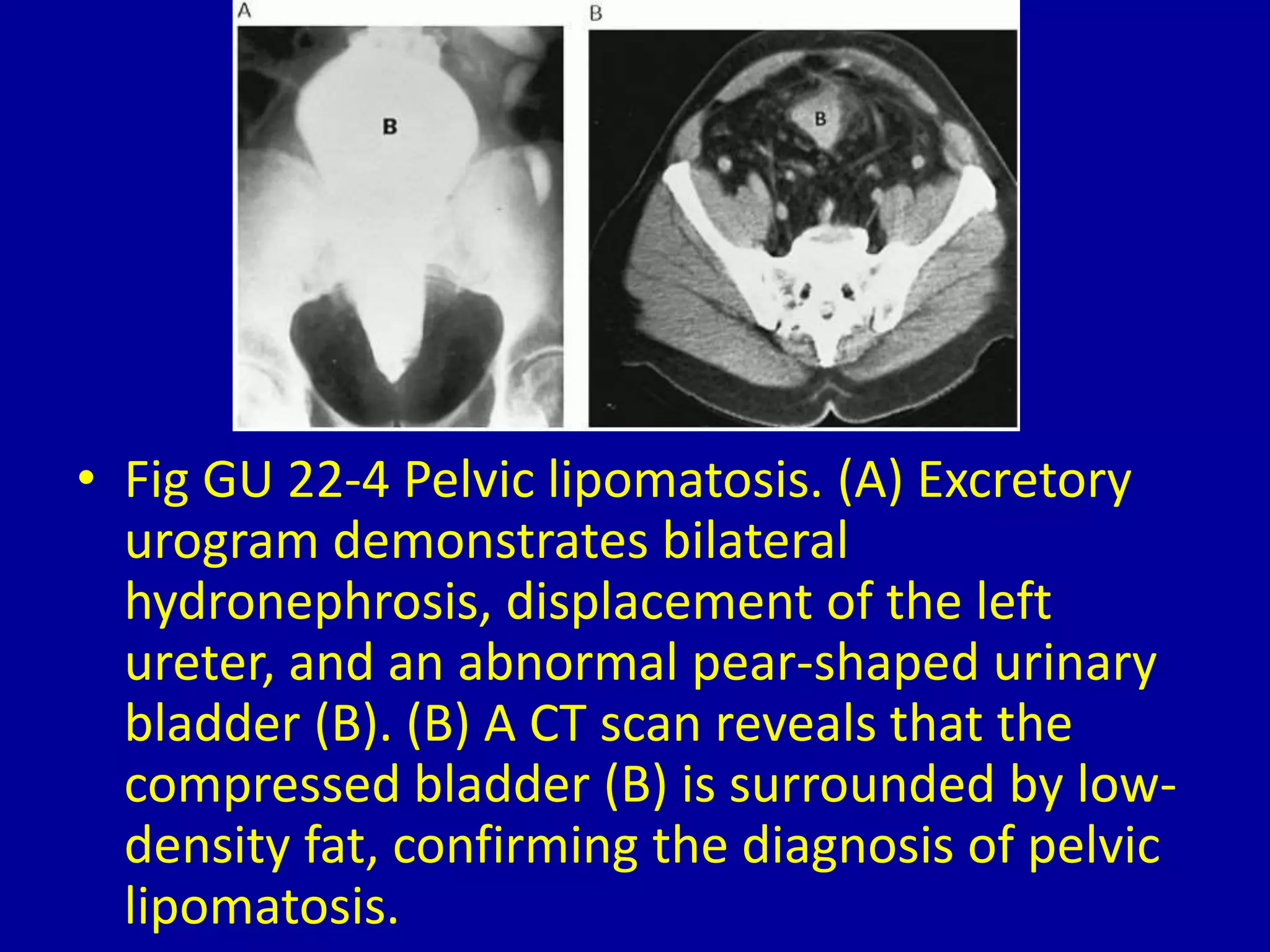 22 small urinary bladder | PPT