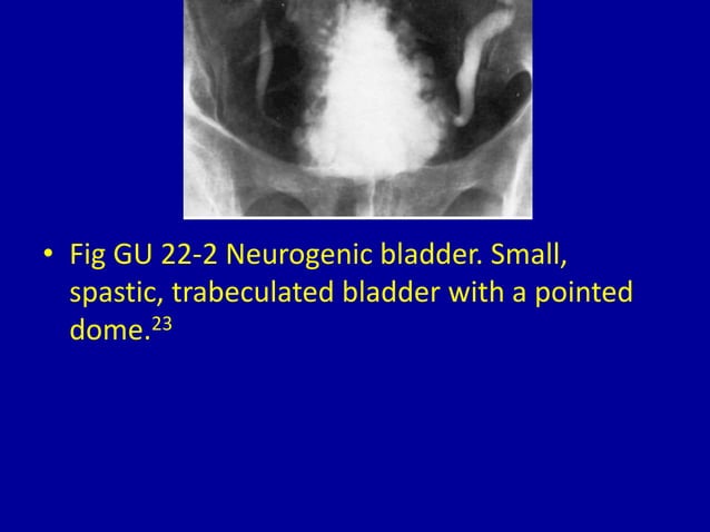 22 small urinary bladder | PPTX