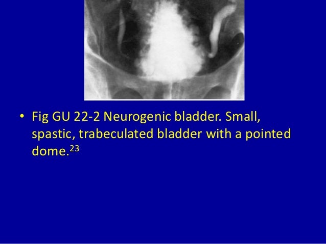 22 small urinary bladder