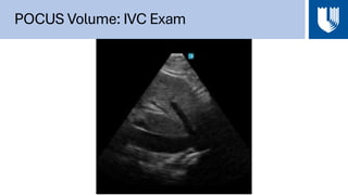 Reviving the Physical Exam: The POCUS Volume Assessment | PDF