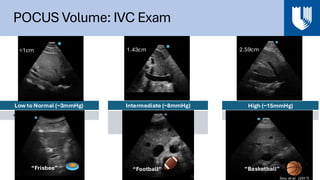Reviving the Physical Exam: The POCUS Volume Assessment | PDF