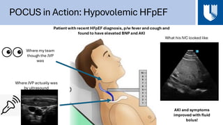 Reviving the Physical Exam: The POCUS Volume Assessment | PDF