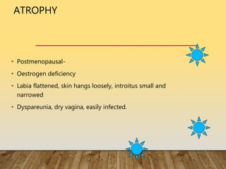 23-03-22Benign Vulval lesions.ppt