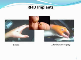 ashok mule rfid presentation | PPT