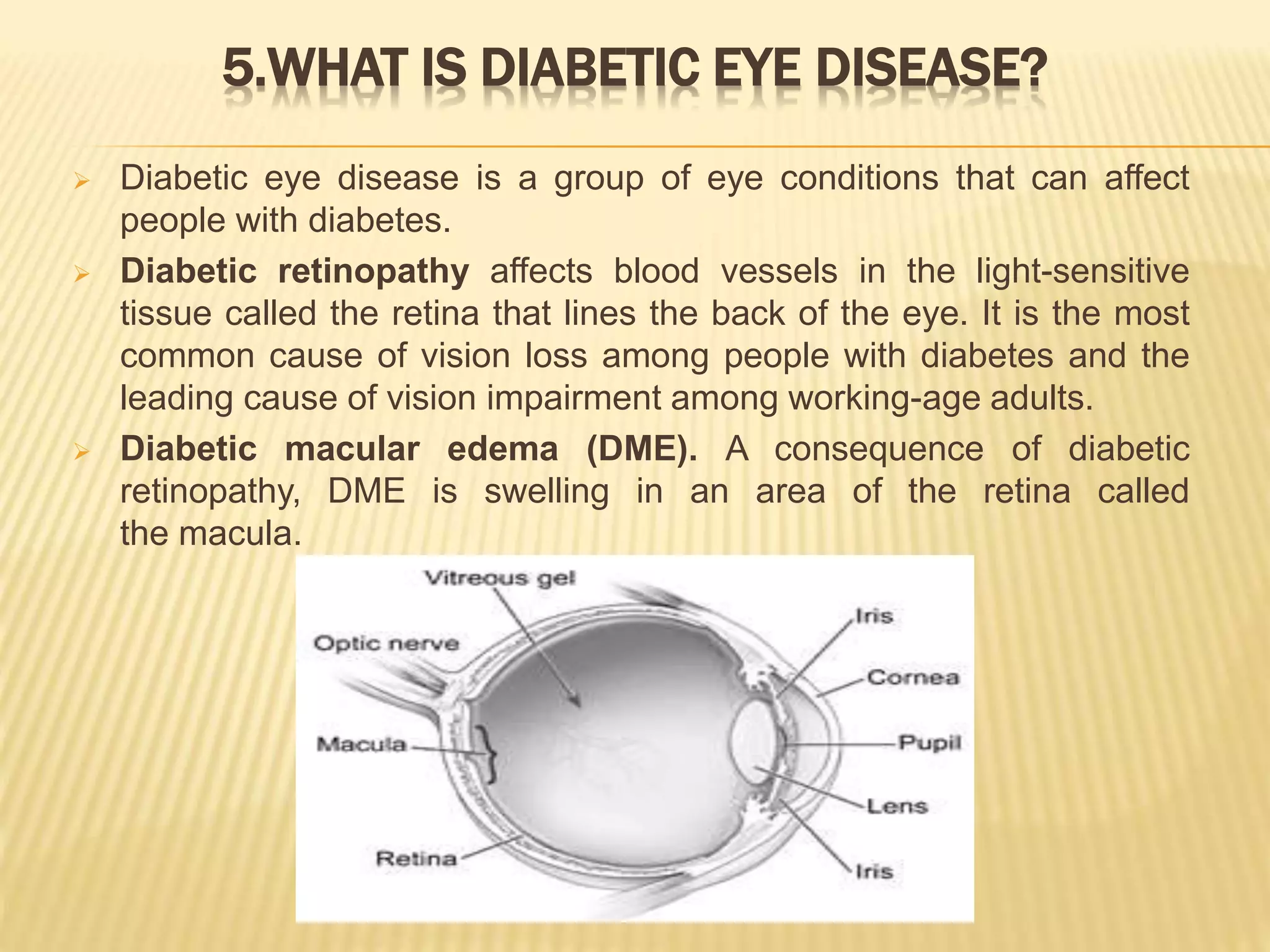 diabetic retinopathy | PPTX