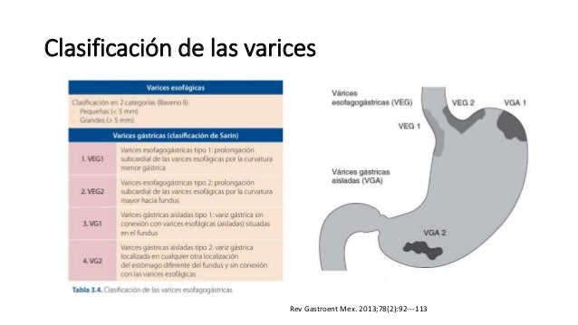 Hemorroagia esofagica variceal