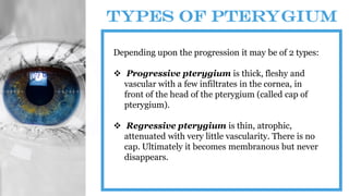 Pterygium (Arma) | PDF