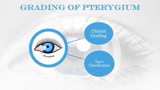 Pterygium (Arma) | PDF